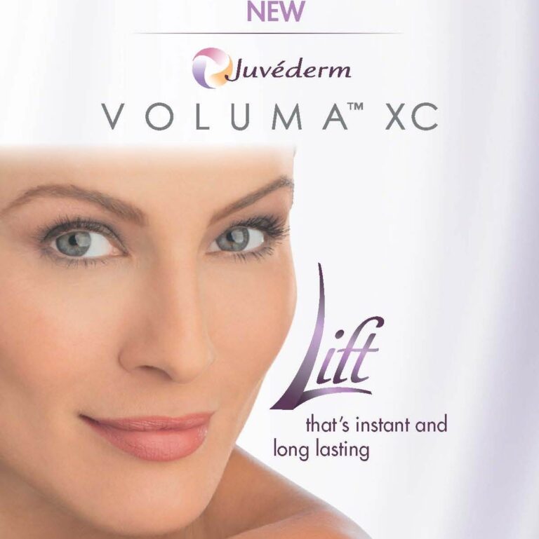 Juvederm Voluma XC - Sullivan Surgery & Spa